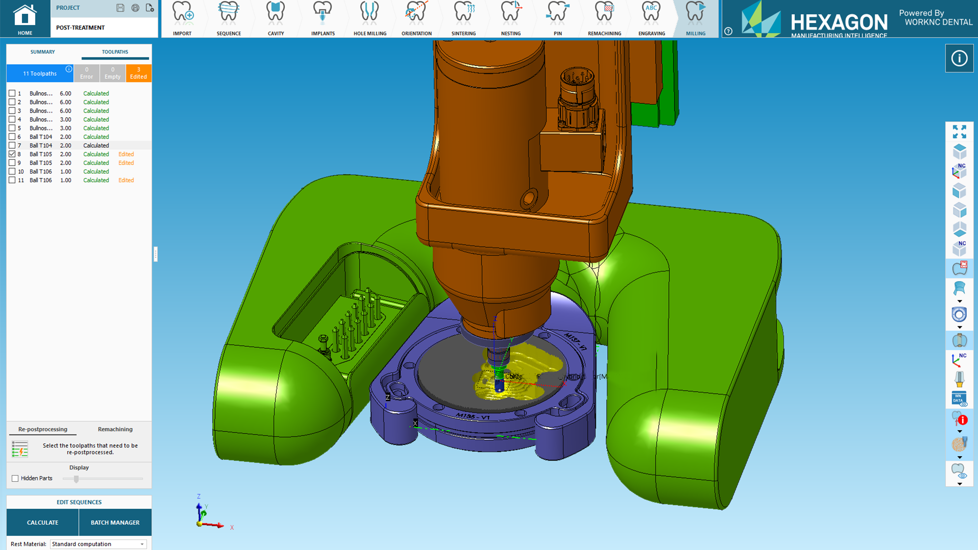 Waveform Halves Dental Prosthesis Machining Time